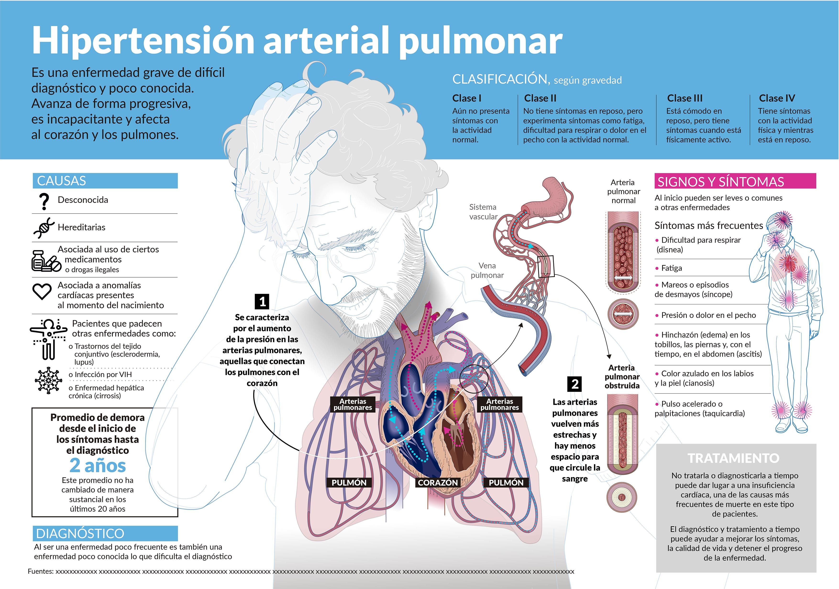 Infografía Hipertensión arterial pulmonar Marcelo Regalado | Domestika